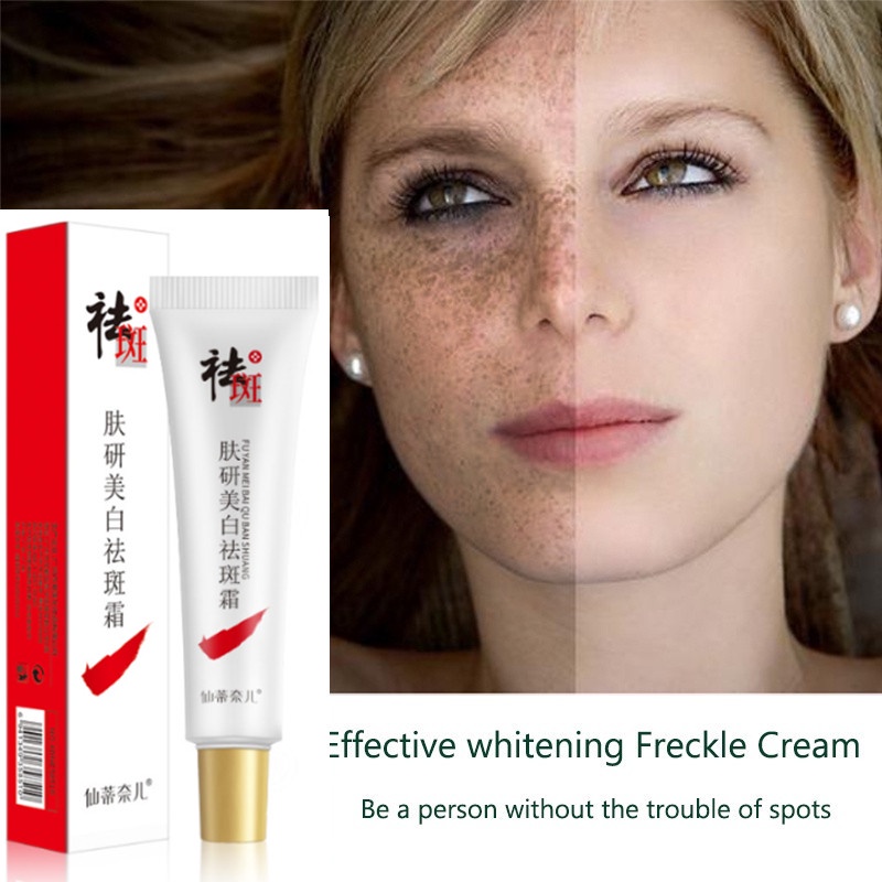 Blanqueamiento Pecas Crema Eliminar Melasma Manchas Oscuras Removedor De Cuidado De La Piel ...