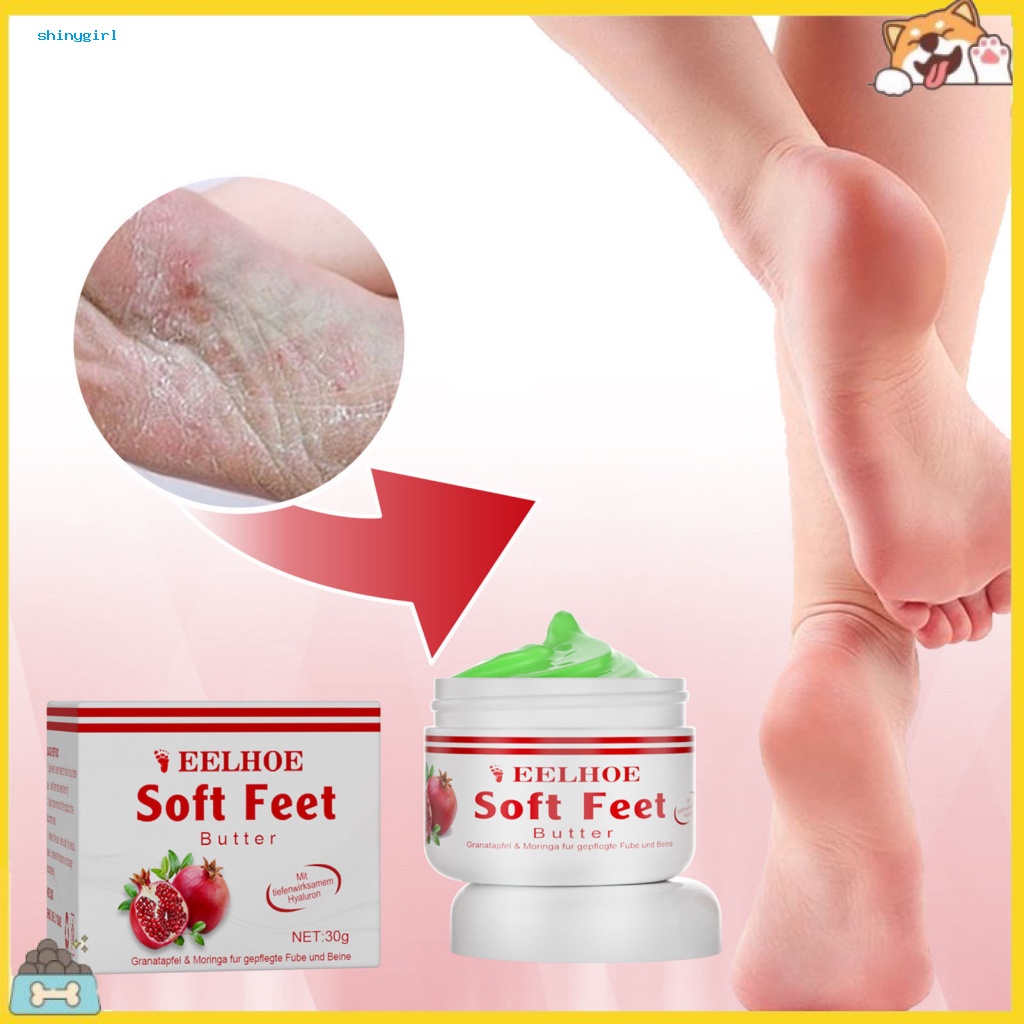 [SG] Hidratante Para Pies Hidratar El Pie Agrietado Peeling Callo Mano ...