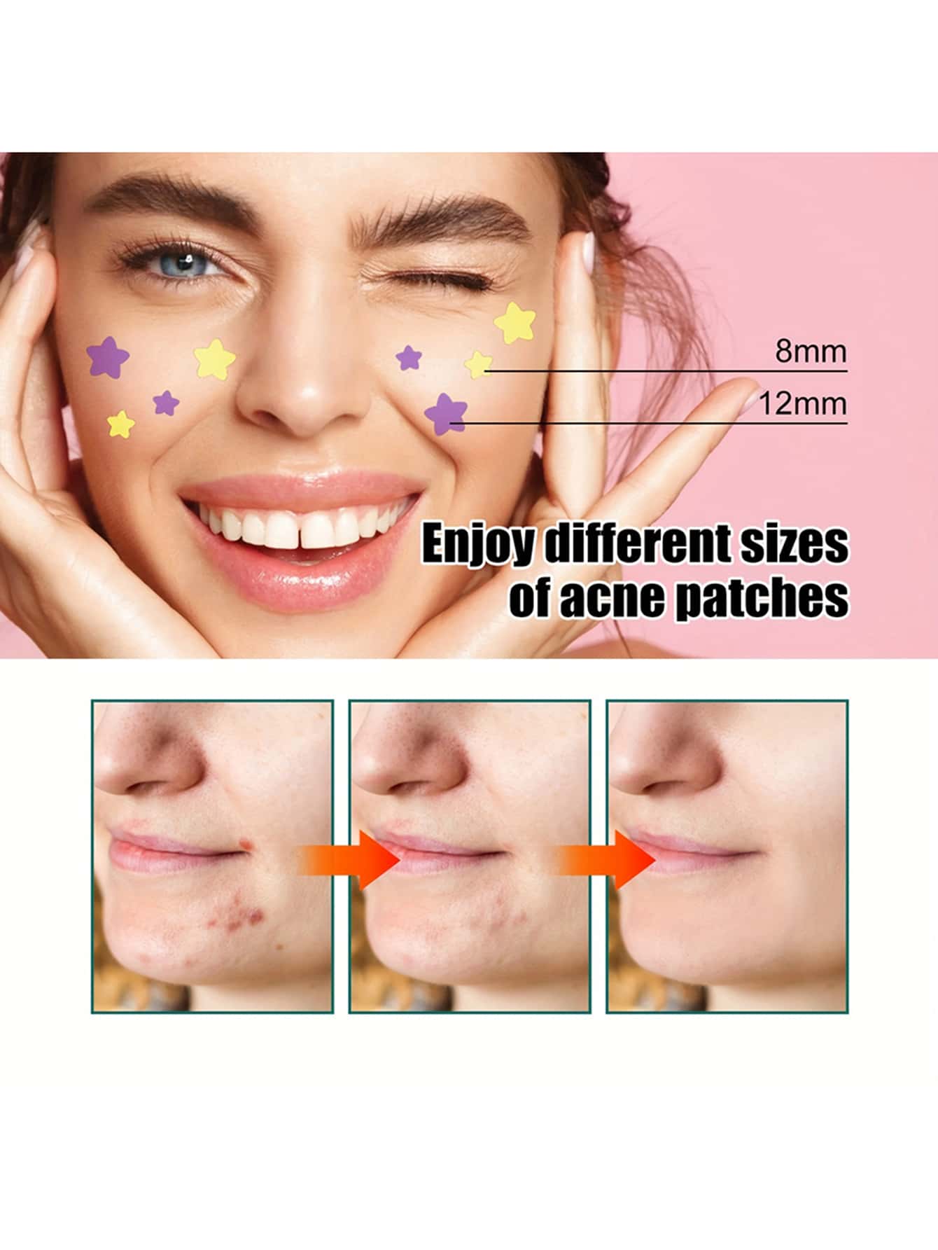 112 Parches De Acné De Colores Para Cubrir Manchas, Marcas De Acné ...