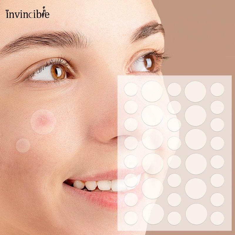 Juego De Parches De Belleza Para El Acné/Removedor De Granos Maestro ...