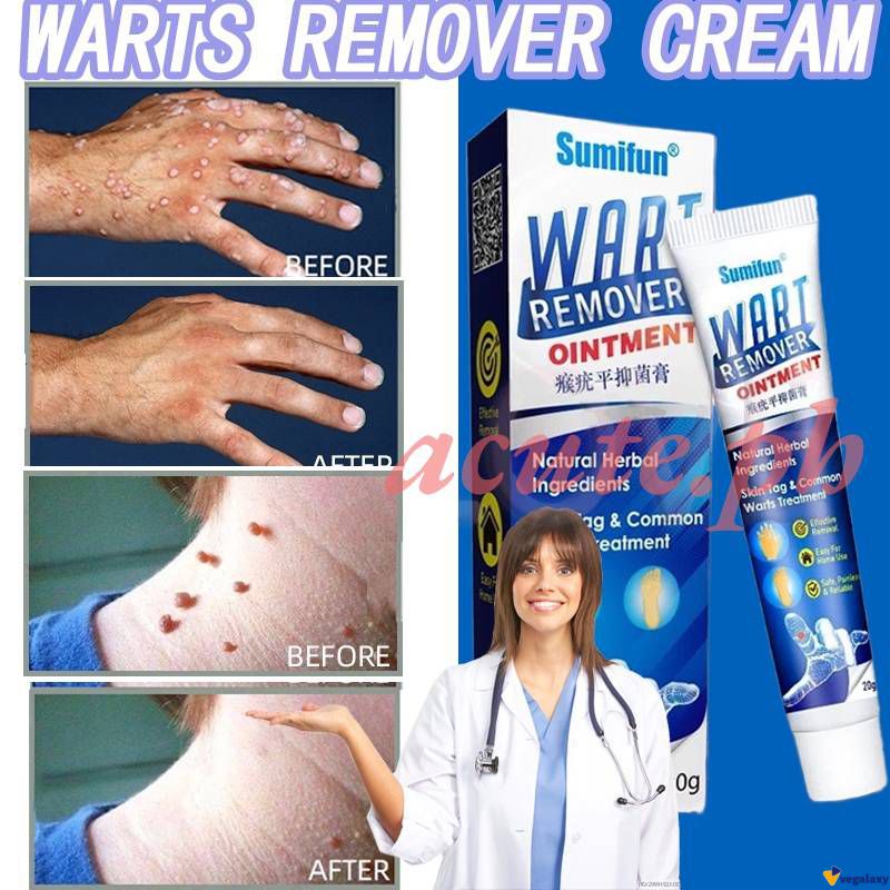 Crema eficaz para eliminar verrugas, eliminación de verrugas, callos en ...