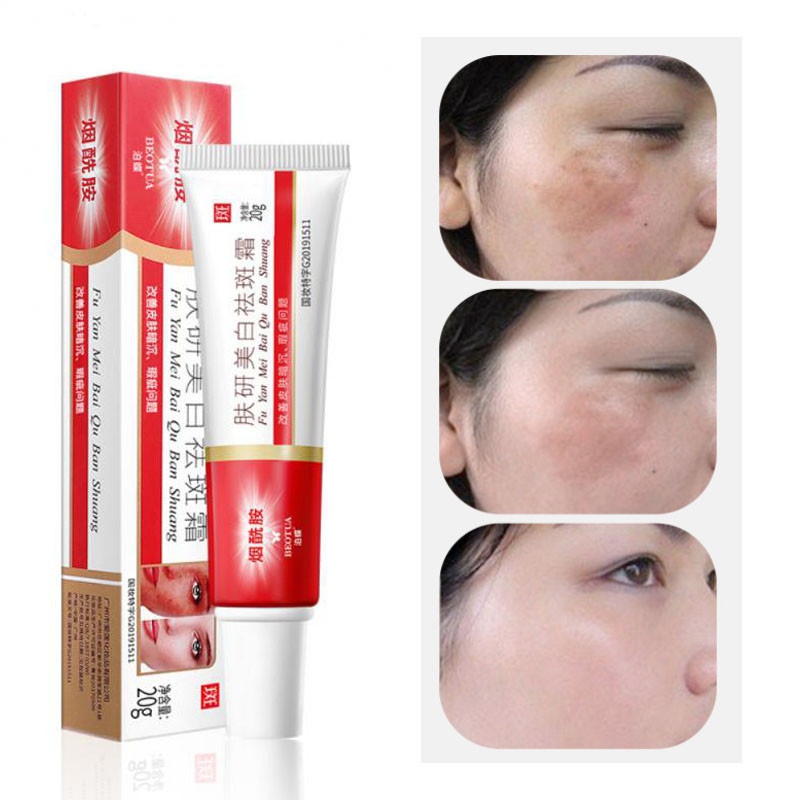 Crema Blanqueadora De Pecas Eliminar De Melasma Manchas Oscuras Melanina Removedor Iluminar La ...