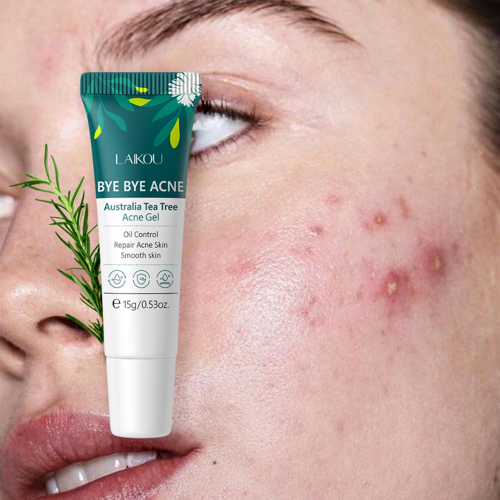 BYE Acne-LAIKOU Australia Tea Tree Gel 15g Unnclog Poros Reduce El Acné ...
